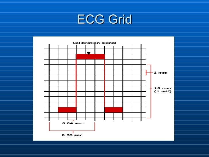Ecg interpretation