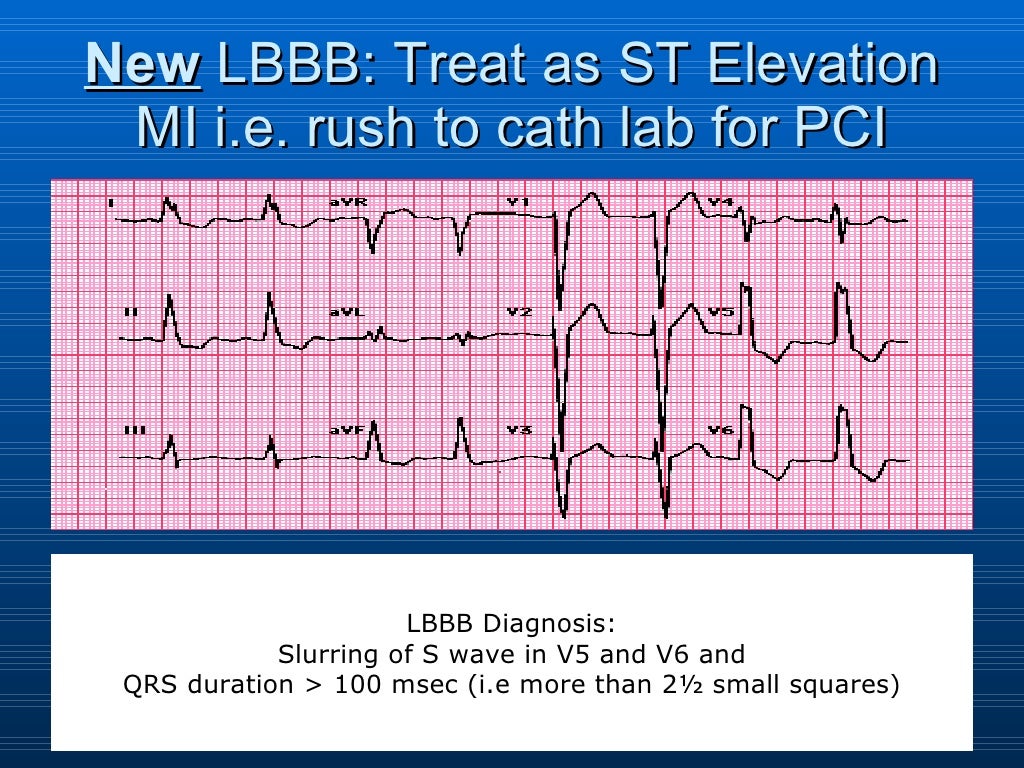 Ecg interpretation