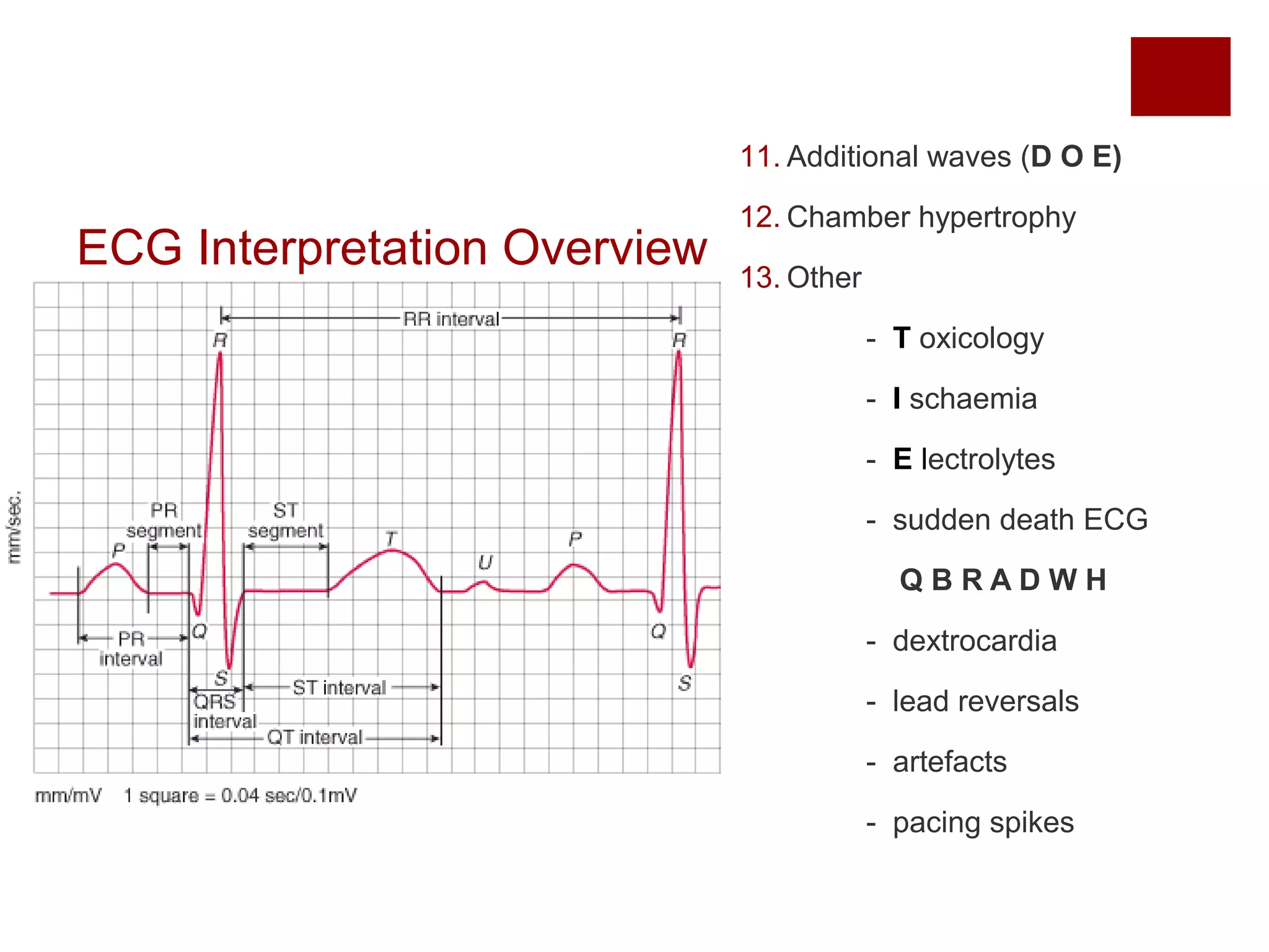 Systematic ECG Interpretation | PPTX