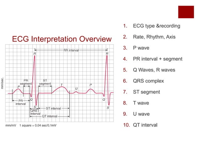 Systematic ECG Interpretation | PPT