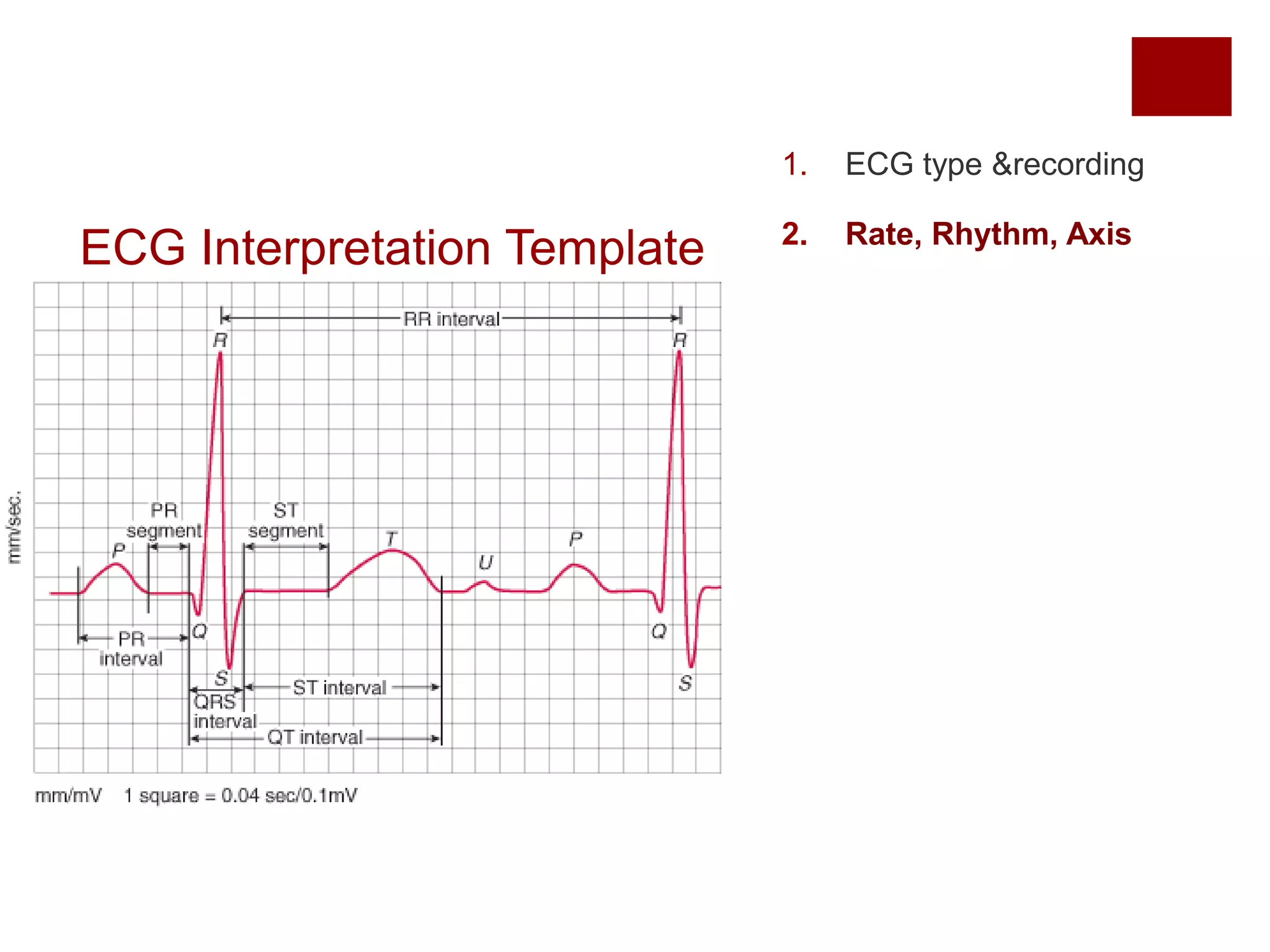 ECG interpretation | PPTX