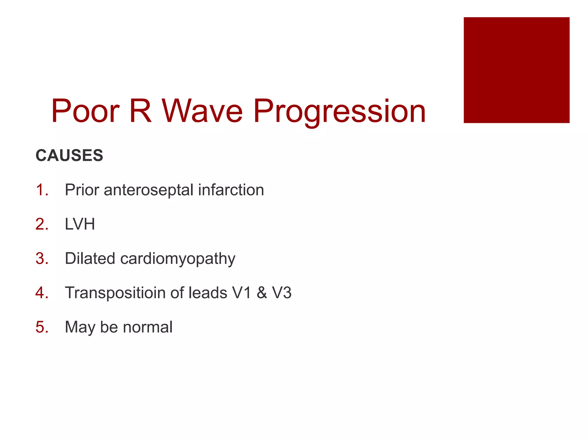 ECG interpretation | PPTX