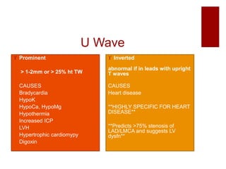 ECG interpretation | PPTX