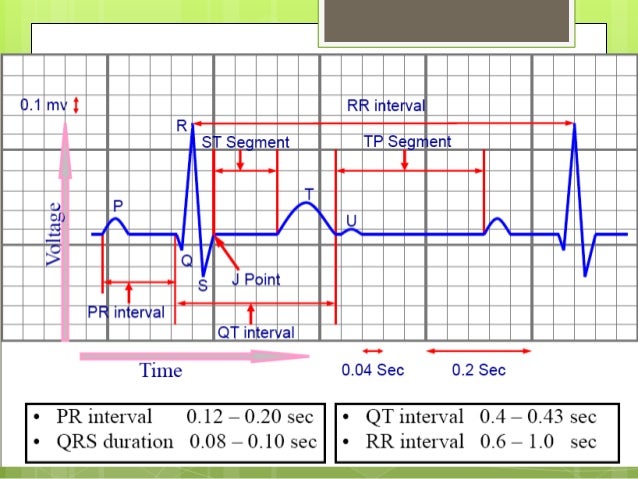 Ecg interpretation
