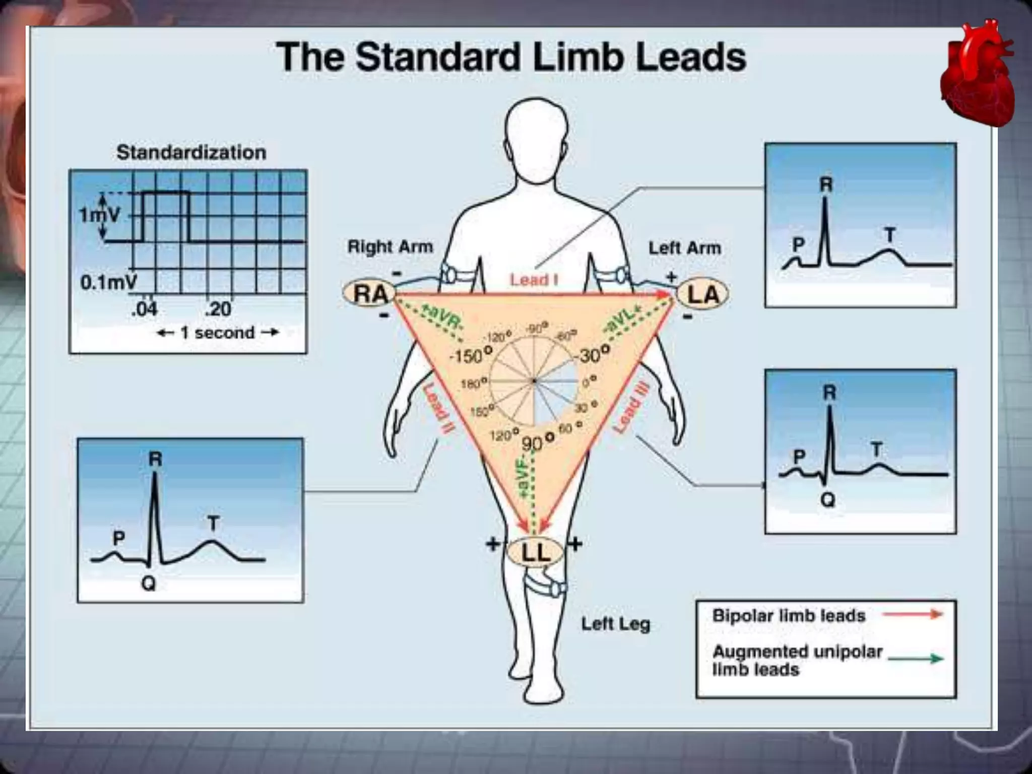 Electrocardiogram interpretation | PPTX