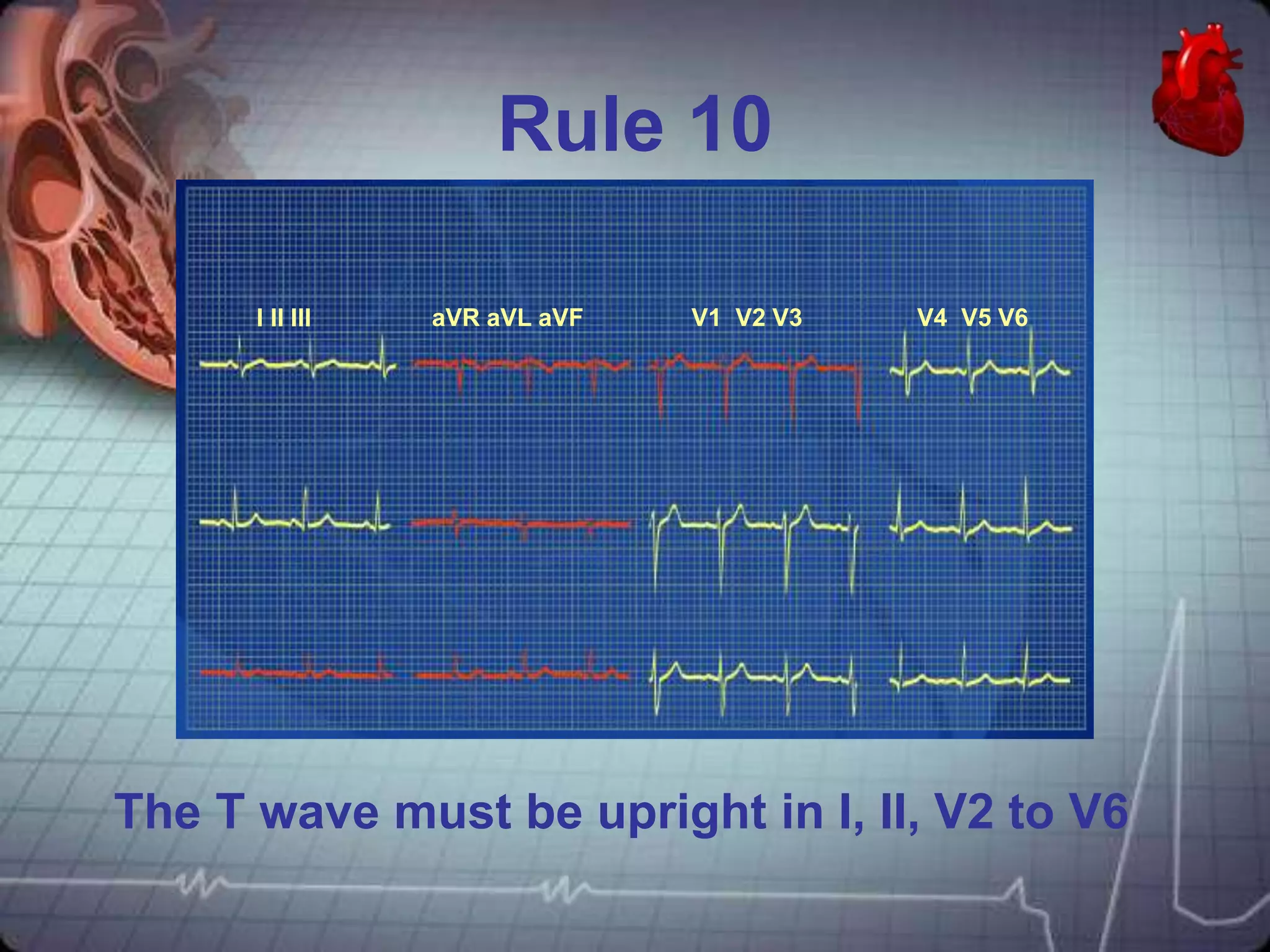 Electrocardiogram interpretation | PPTX