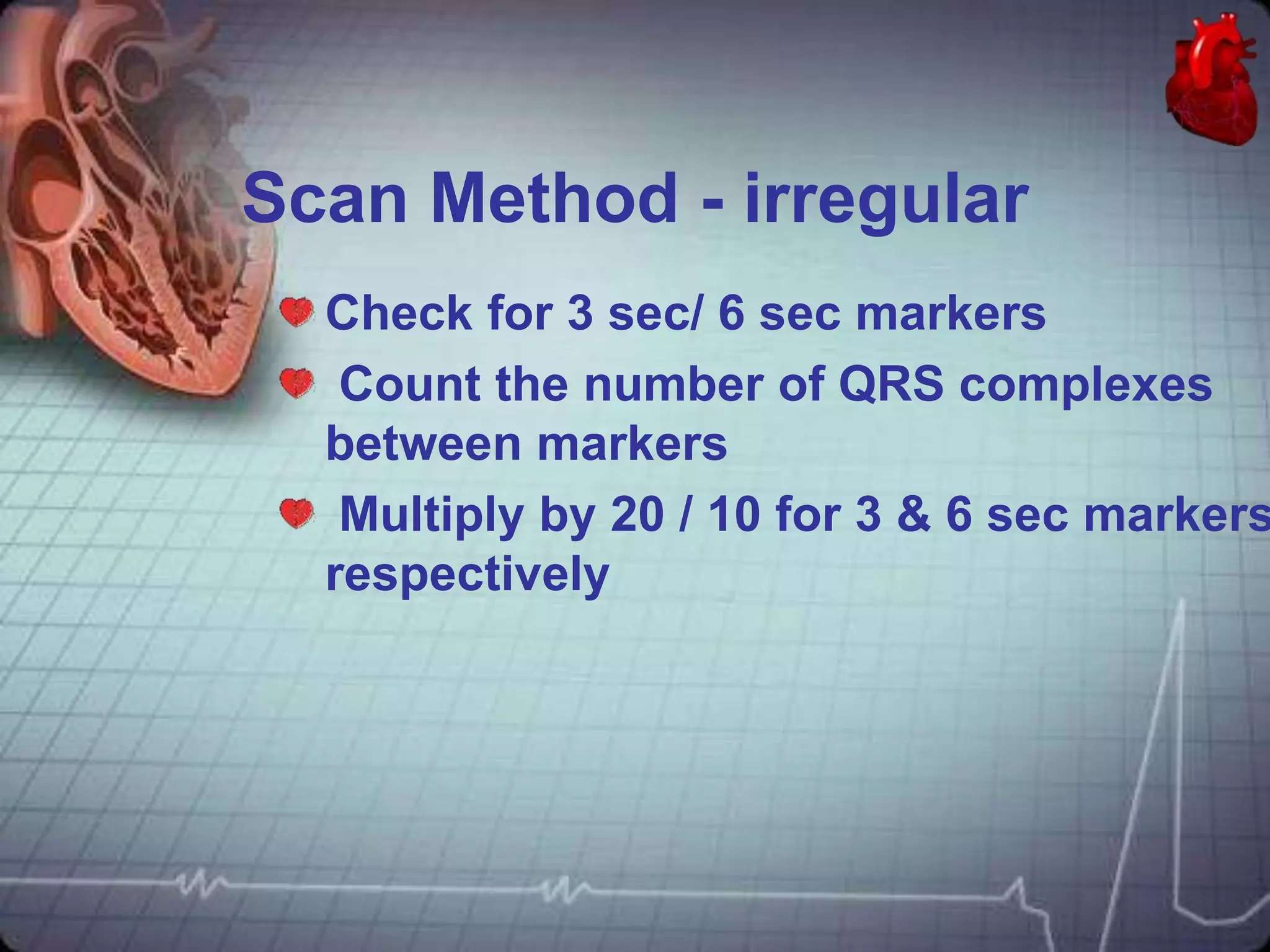 Electrocardiogram interpretation | PPTX