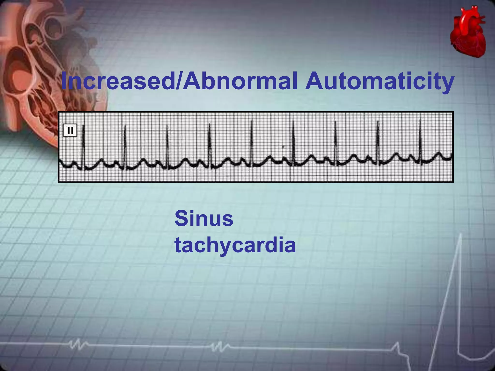 Electrocardiogram interpretation | PPTX