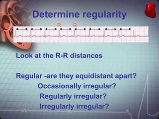 Electrocardiogram interpretation | PPTX