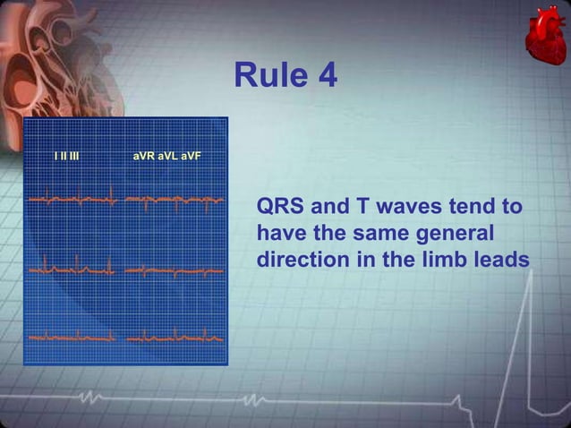 Electrocardiogram interpretation | PPTX | Heart and Cardiovascular Diseases | Diseases and ...