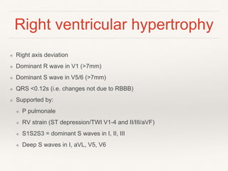 ECG interpretation | PPTX