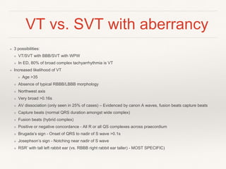 ECG interpretation | PPTX