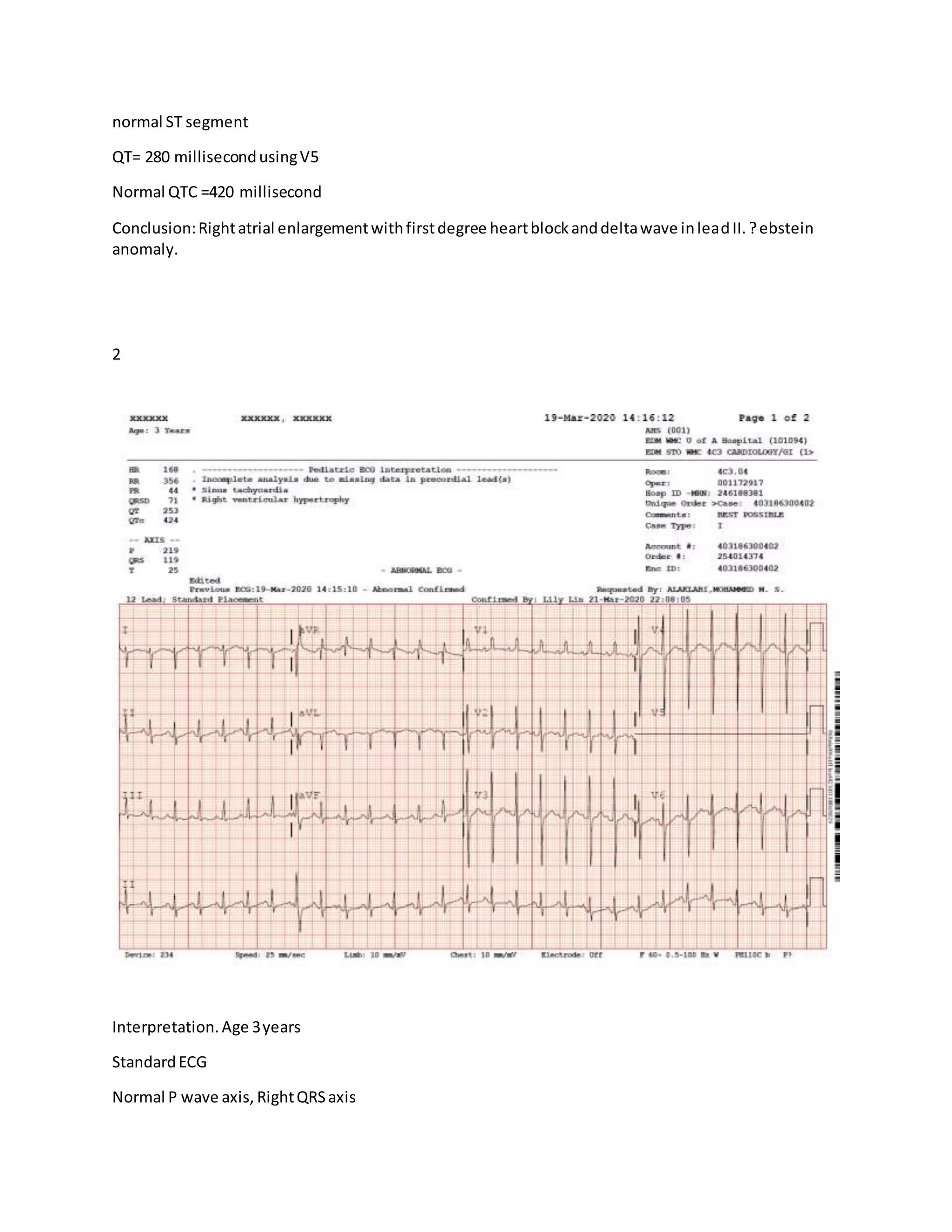 Ecg interpretation | PDF