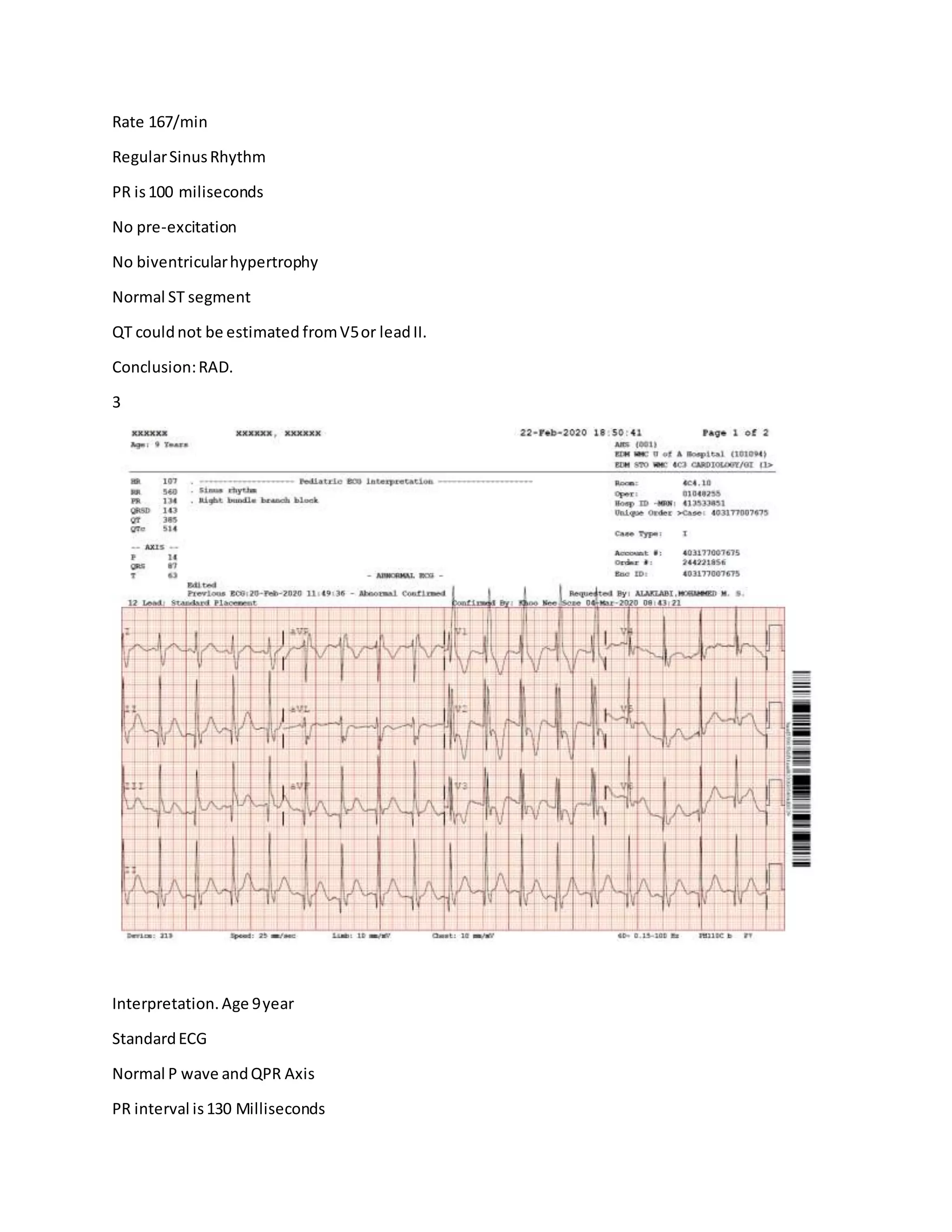 Ecg interpretation | PDF