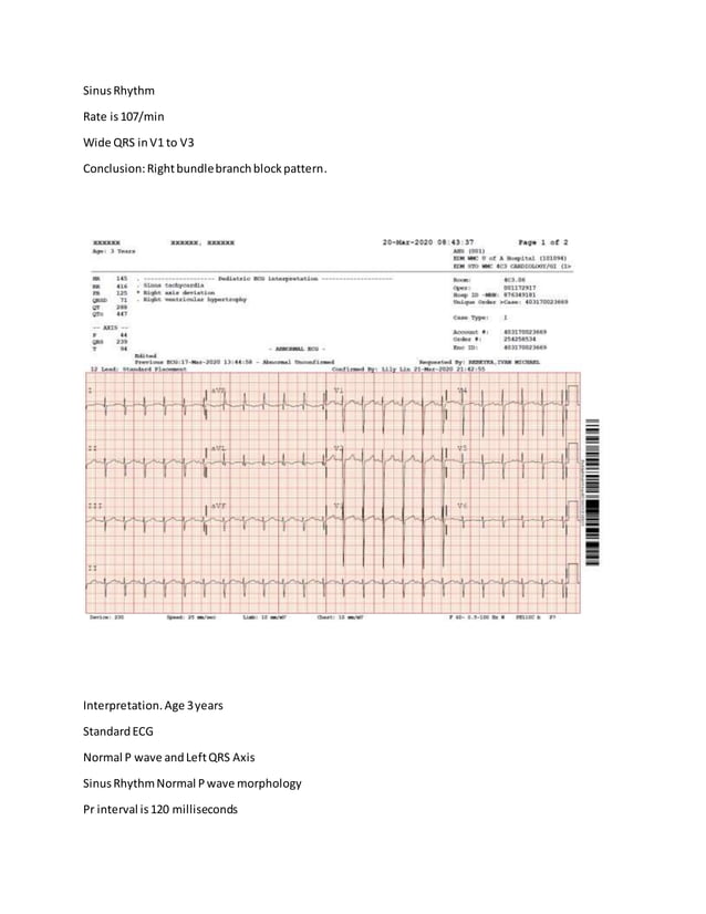 Ecg interpretation | PDF