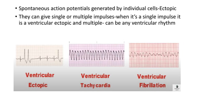 Ecg interpretation | PPT