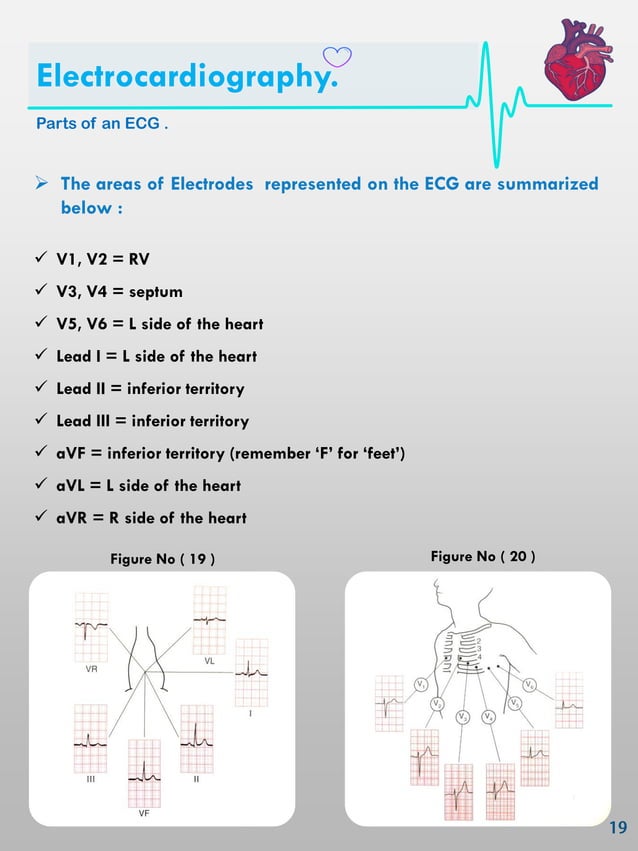 Ecg interpretation | PDF