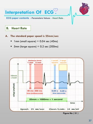 Ecg interpretation | PDF