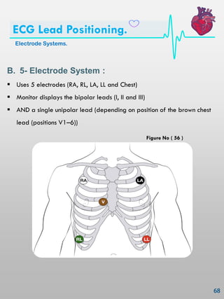 Ecg interpretation | PDF