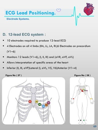 Ecg interpretation | PDF