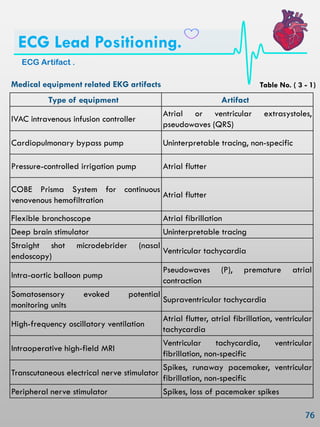 Ecg interpretation | PDF