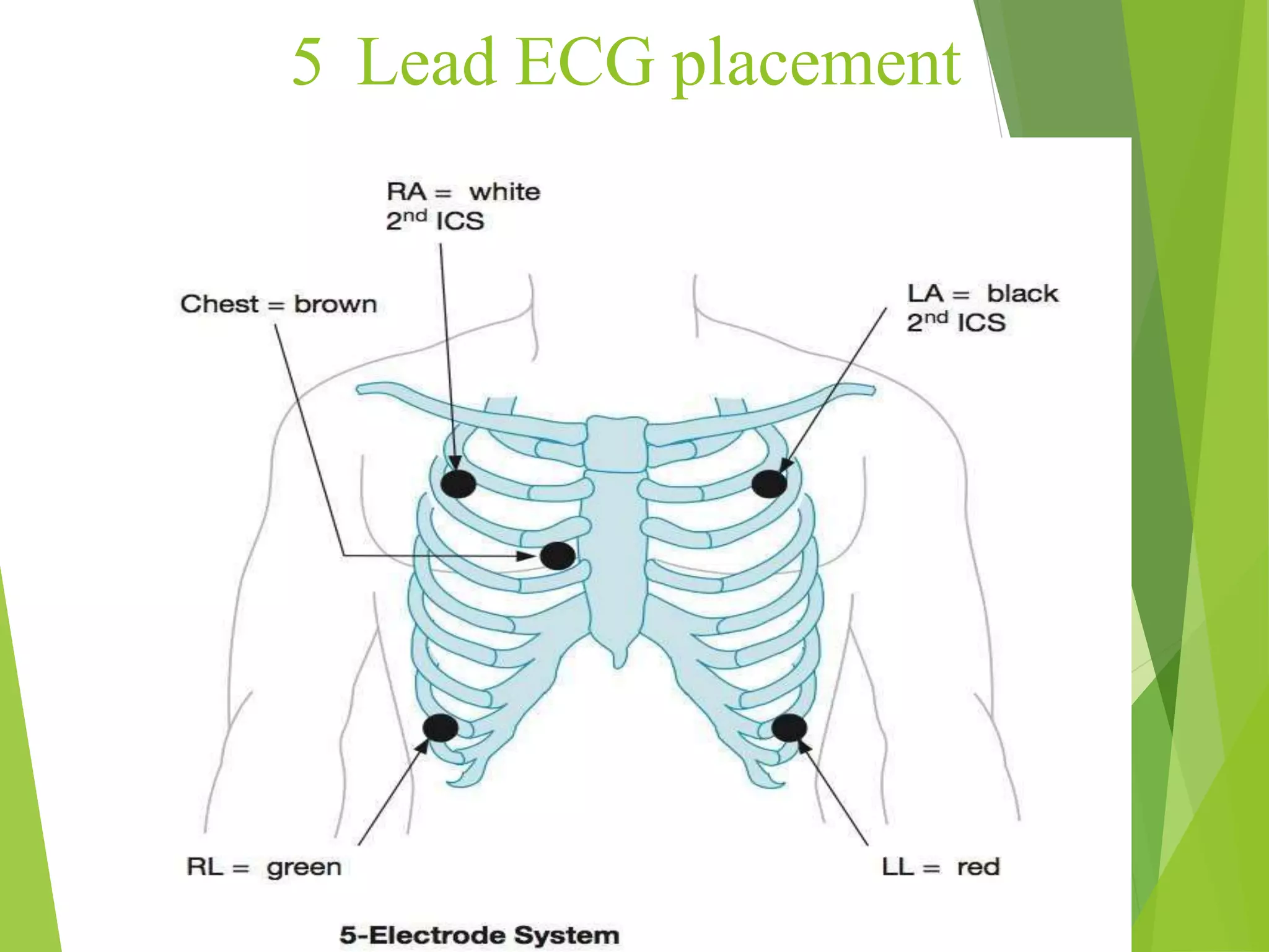 Ecg interpretation | PPTX | Heart and Cardiovascular Diseases | Diseases and Conditions
