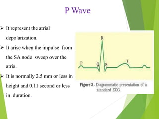 Ecg interpretation | PPTX