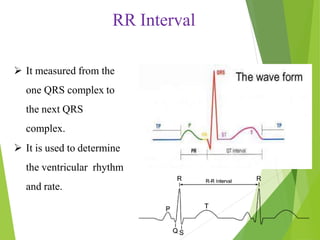 Ecg interpretation | PPTX | Heart and Cardiovascular Diseases ...