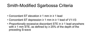 Ecg interpretation , Upgraded | PPTX