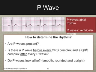 ECG Interpretation | PPTX