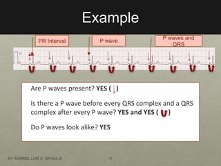 ECG Interpretation | PPTX