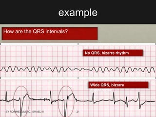 ECG Interpretation | PPTX