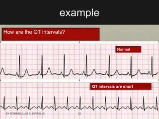ECG Interpretation | PPTX
