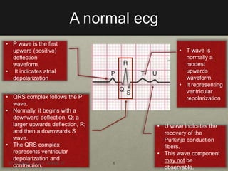 ECG Interpretation | PPTX