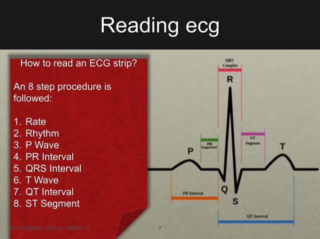 ECG Interpretation | PPTX