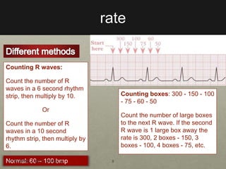 ECG Interpretation | PPTX