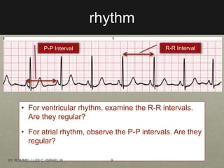 ECG Interpretation | PPTX