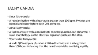 ECG INTERPRETATION for physiotherapy students | PPTX