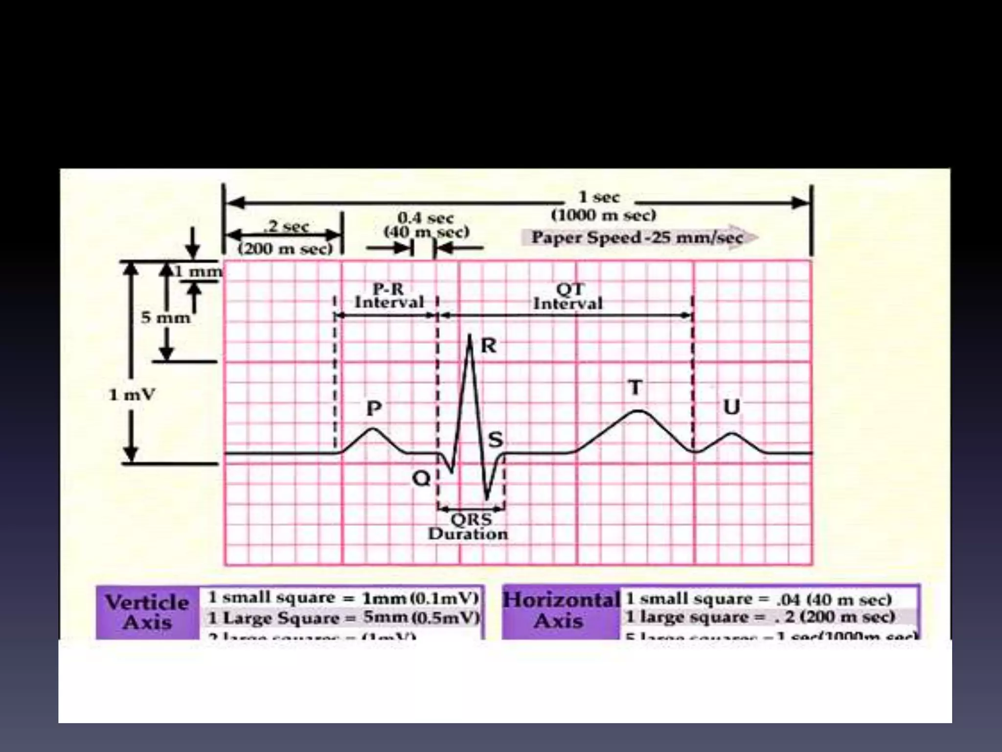 Systematic ECG Interpretation | PPTX