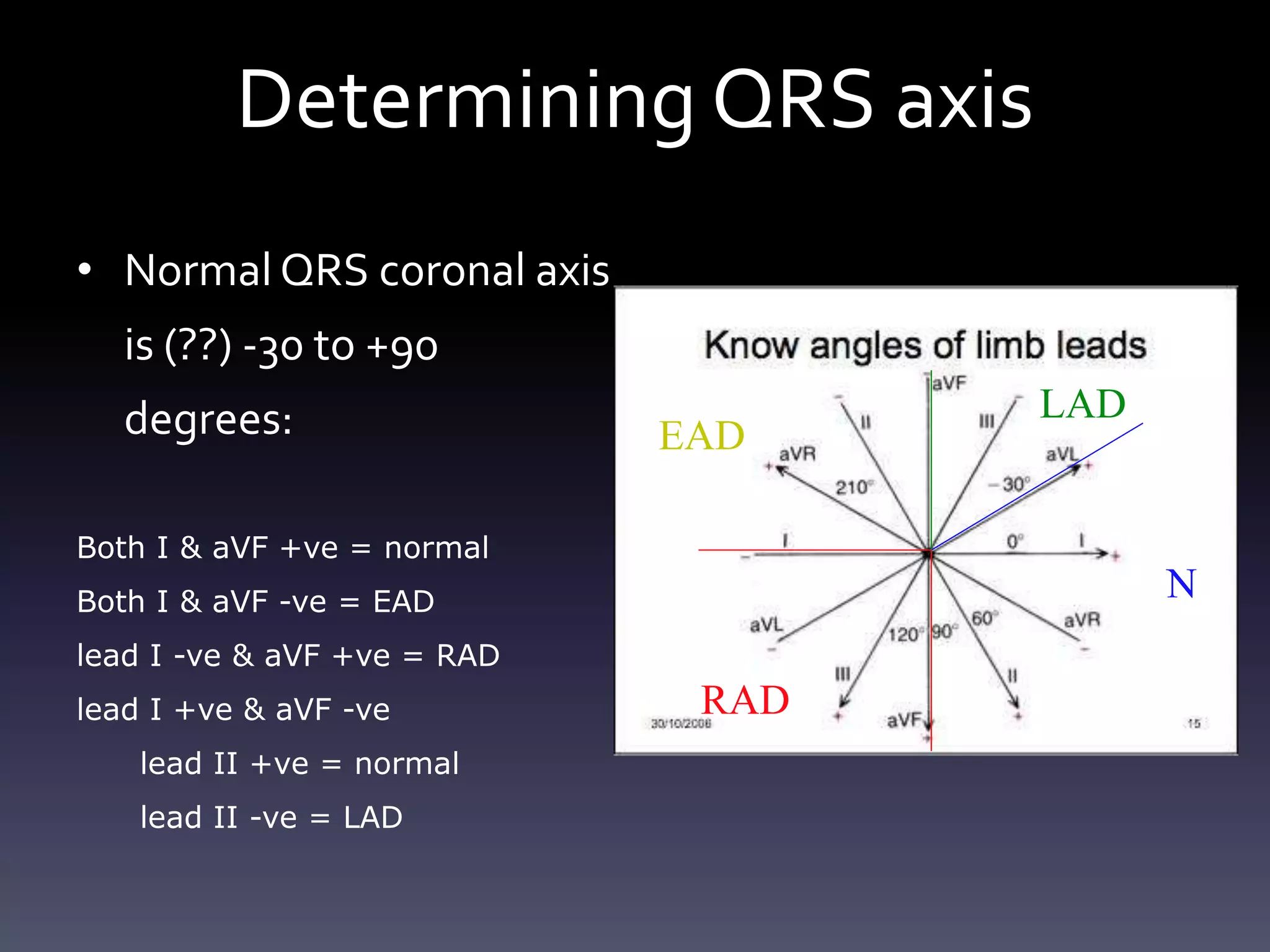 Systematic ECG Interpretation | PPTX