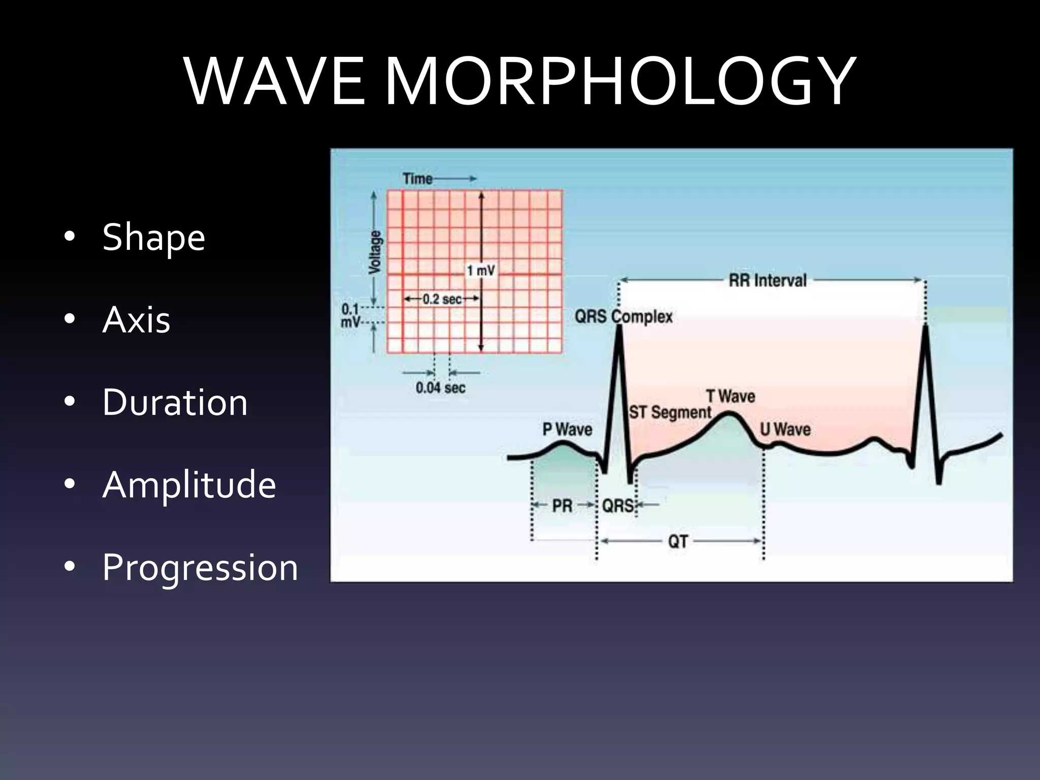 Systematic ECG Interpretation | PPTX
