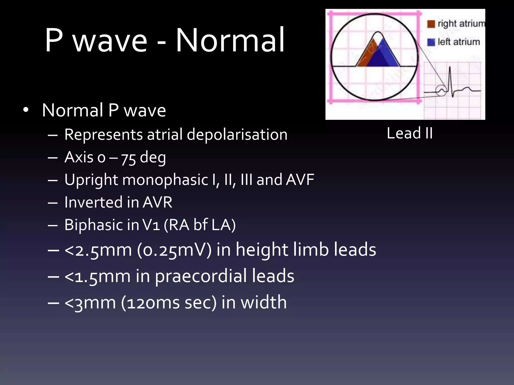 Systematic ECG Interpretation | PPTX