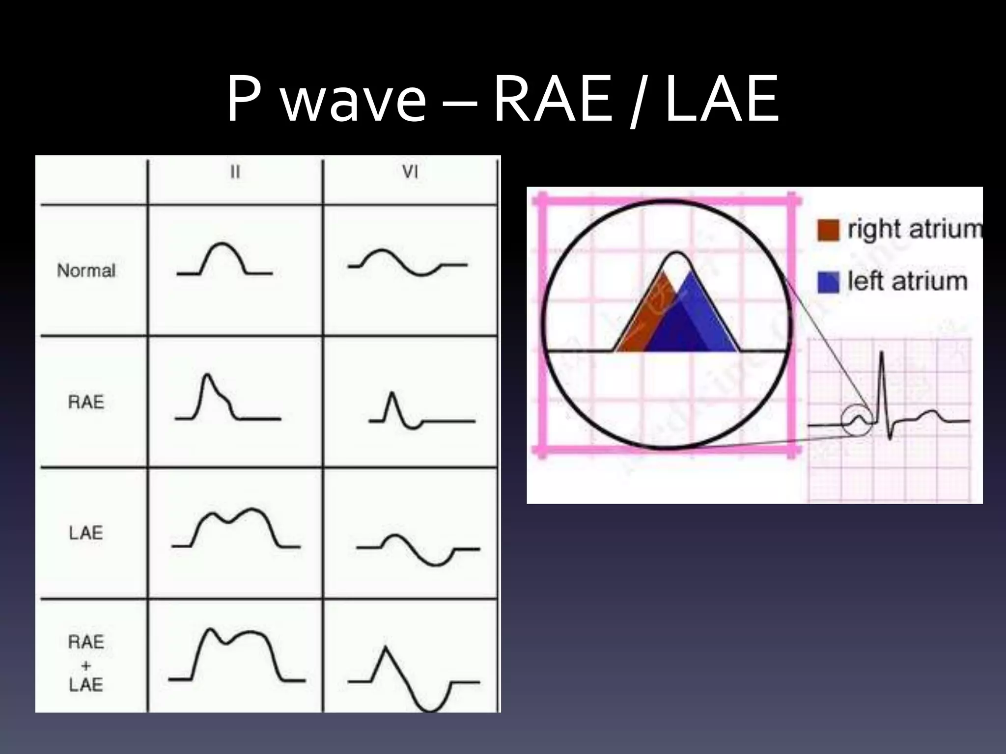 Systematic ECG Interpretation | PPTX
