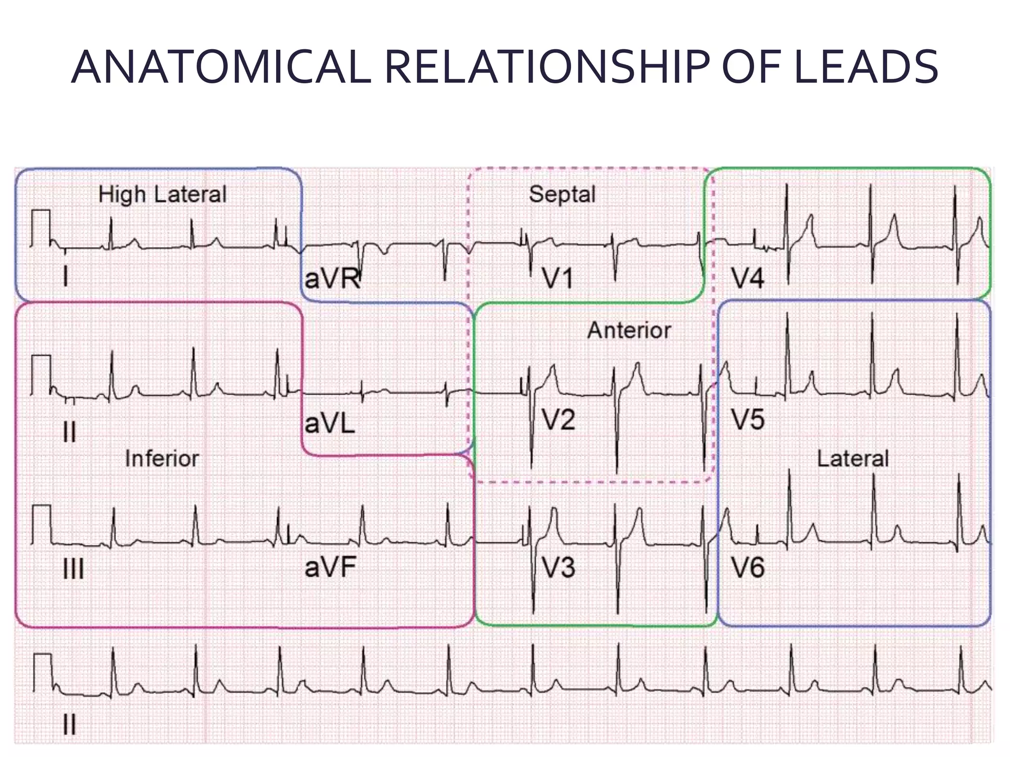 Systematic ECG Interpretation | PPTX
