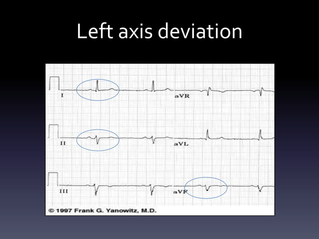 Systematic ECG Interpretation | PPTX | Heart and Cardiovascular ...