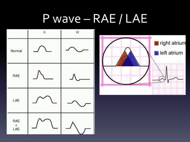 Systematic ECG Interpretation | PPTX | Heart and Cardiovascular Diseases | Diseases and Conditions