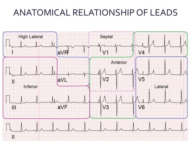 Systematic ECG Interpretation | PPTX | Heart and Cardiovascular ...