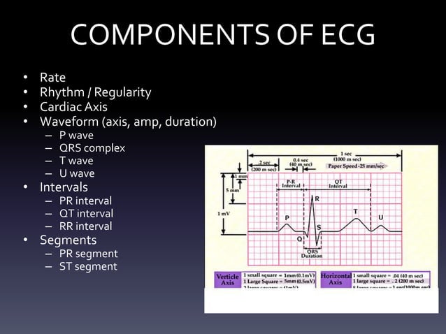 Systematic ECG Interpretation | PPTX | Heart and Cardiovascular Diseases | Diseases and Conditions