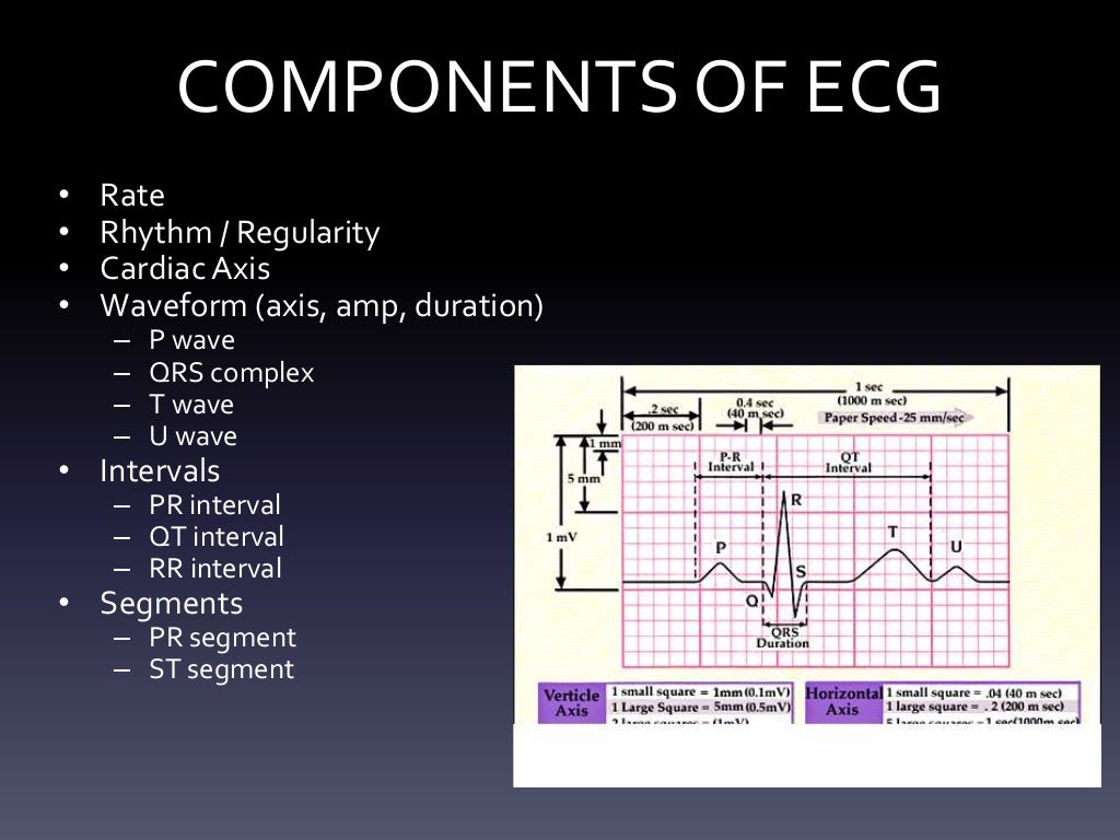Systematic ECG Interpretation