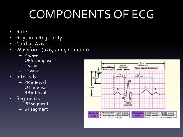 Systematic Ecg Interpretation | Healthcare Student